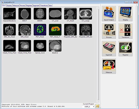 APRO2 - AnalyzeDirect