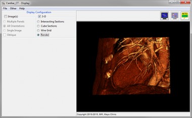 Analyze 14.0 - AnalyzeDirect