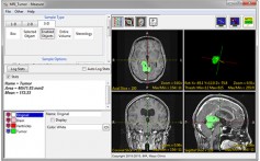 Analyze 14.0 - AnalyzeDirect