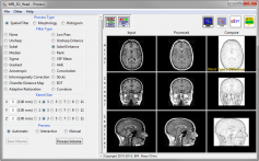 Analyze 14.0 - AnalyzeDirect