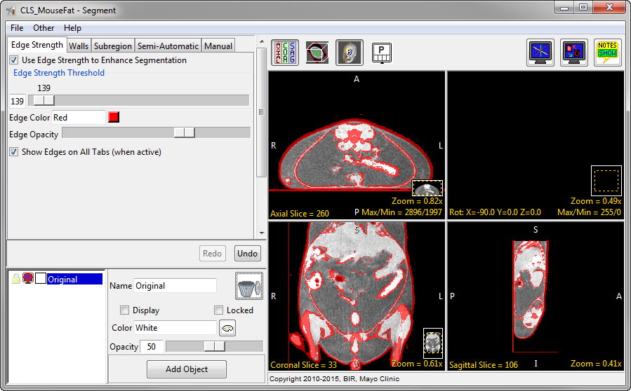 Analyze 15.0 Segment Tools - AnalyzeDirect